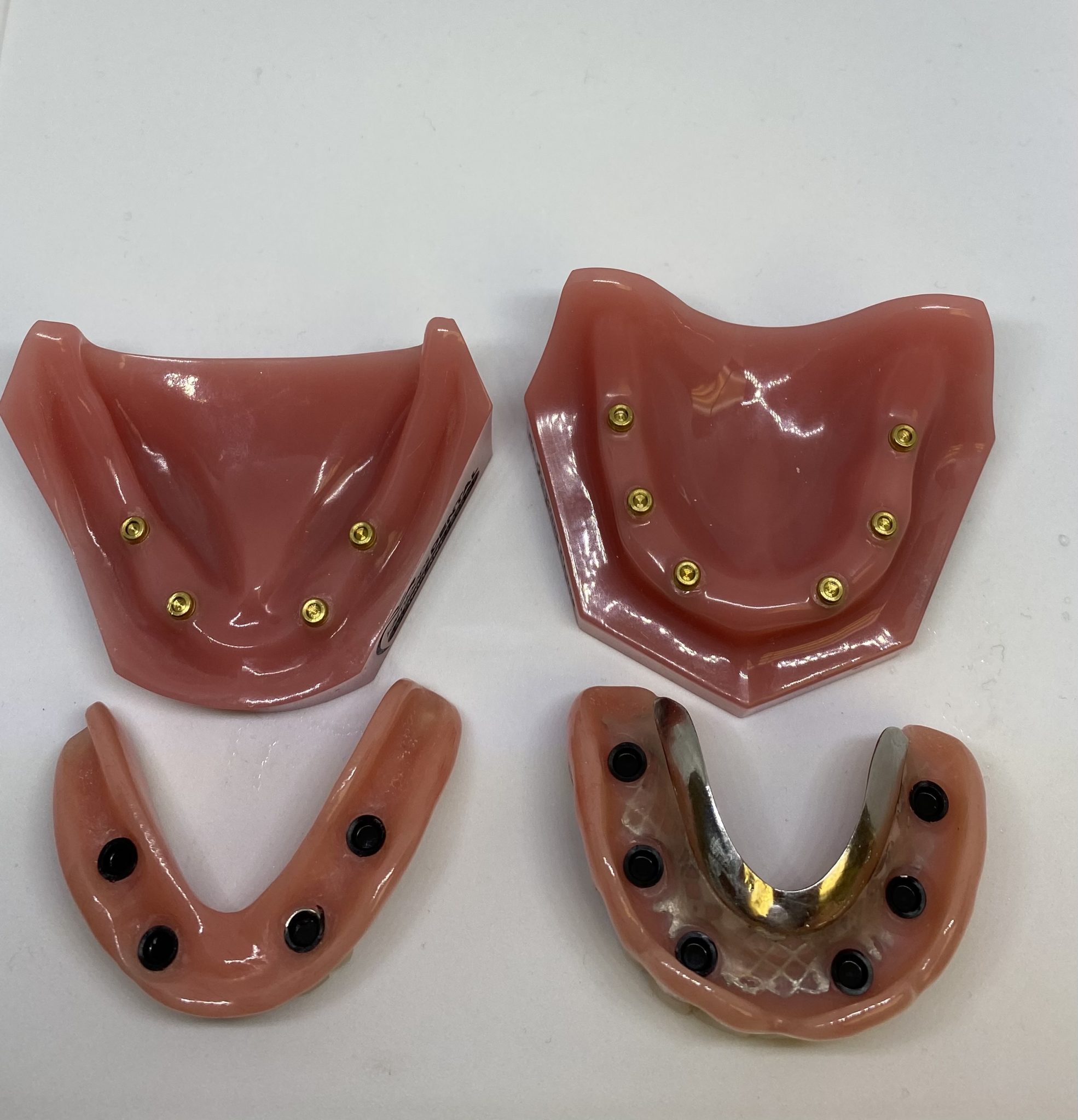 Implant Over-dentures - Kasper Denture Clinic